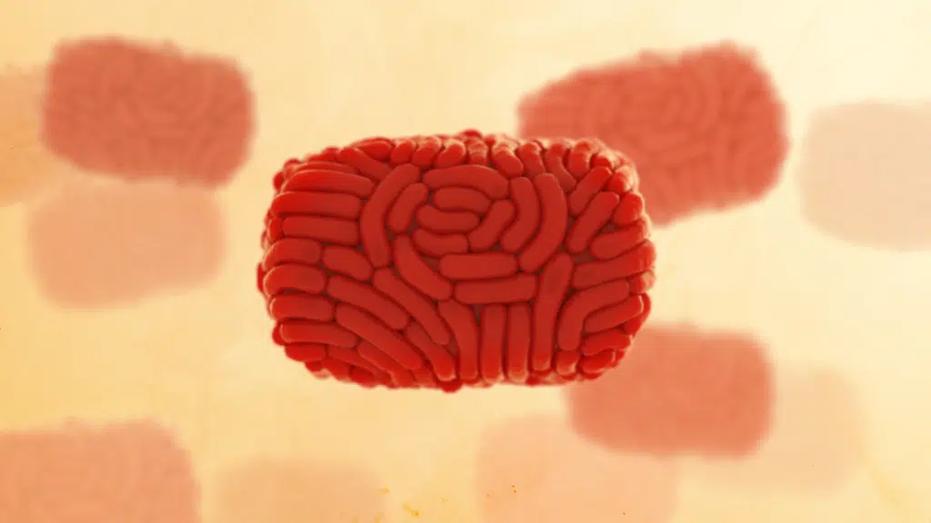 A new mpox variant is taking off in Africa. The WHO plan for stopping ...
